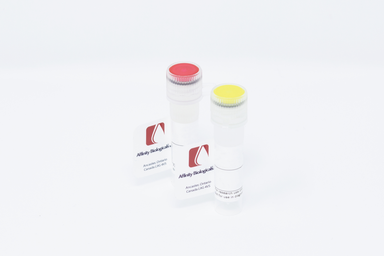 Factor XII Inhibitor Plasma, 1ml vial - (Mild) - Frozen | Quadratech ...