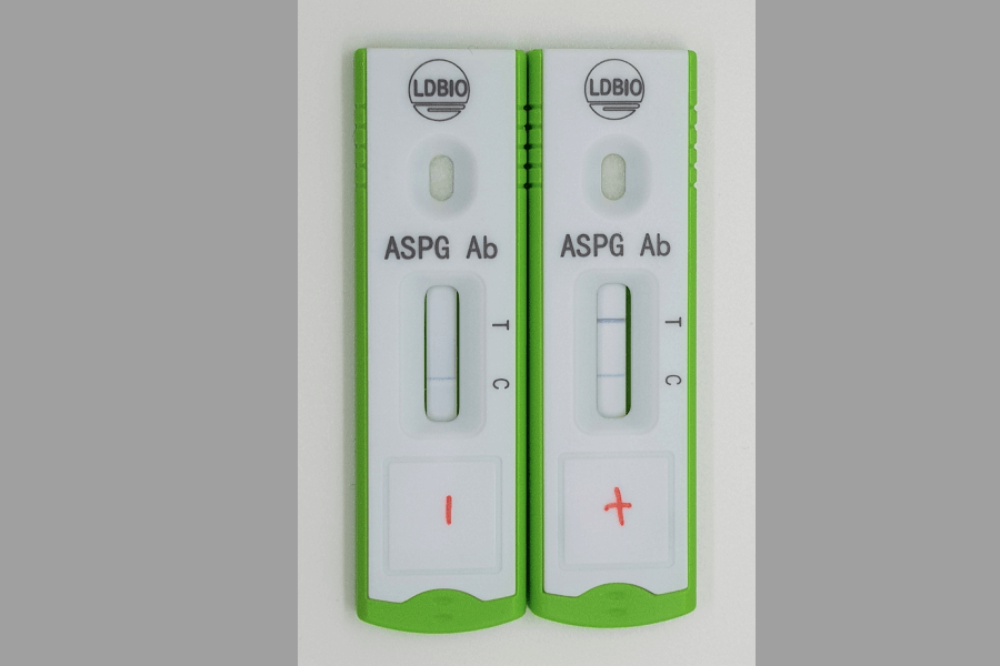 Aspergillus Western Blot IgG (24T) | Quadratech Diagnostics