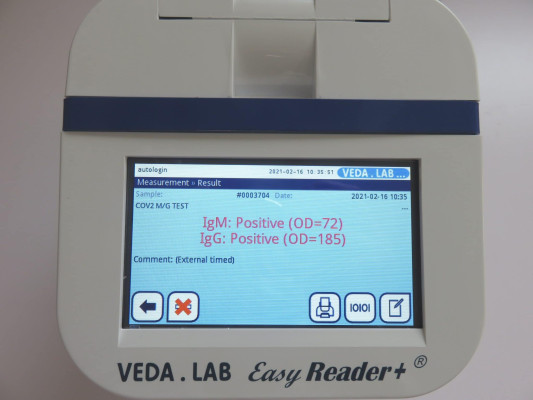 Easy Reader+® Immunochromatographic Test Reader | Quadratech Diagnostics